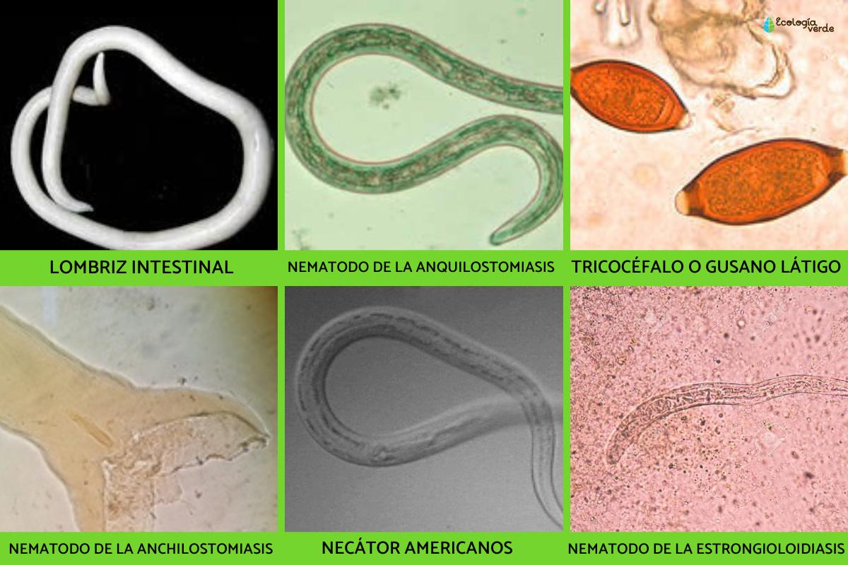 Qué son los nematodos: características, clasificación y ejemplos - FOTOS